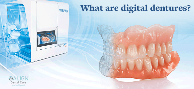 What are digital dentures?