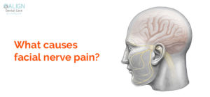 What causes facial nerve pain?
