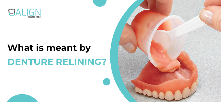 Denture reline | Denture relining