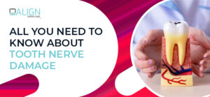 All you need to know about tooth nerve damage